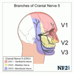 CN5 Trigeminal Nerve - Dermatomes Chart and Map