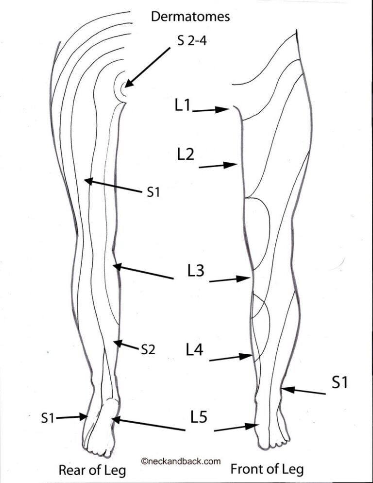 Dermatome Patterns Dermatome Map Of Lower Body Spine N Flickr ...